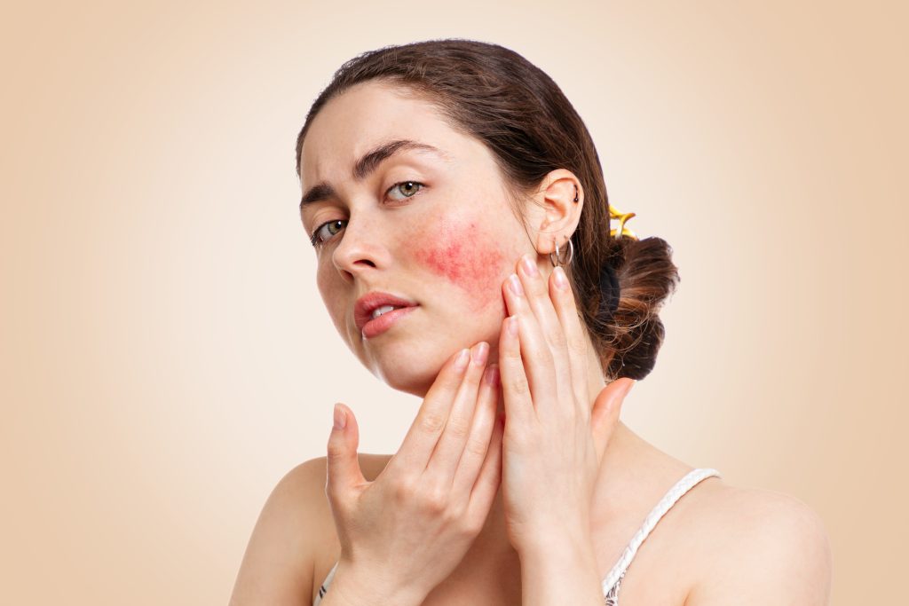 Comment vous débarrasser de l'eczéma du visage et du cou